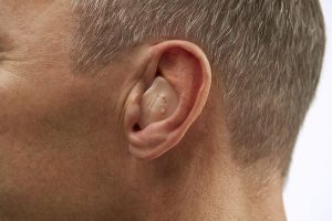 Custom Hearing Aids - Canal Styles (IIC, CIC) - Hearing Aids Singapore